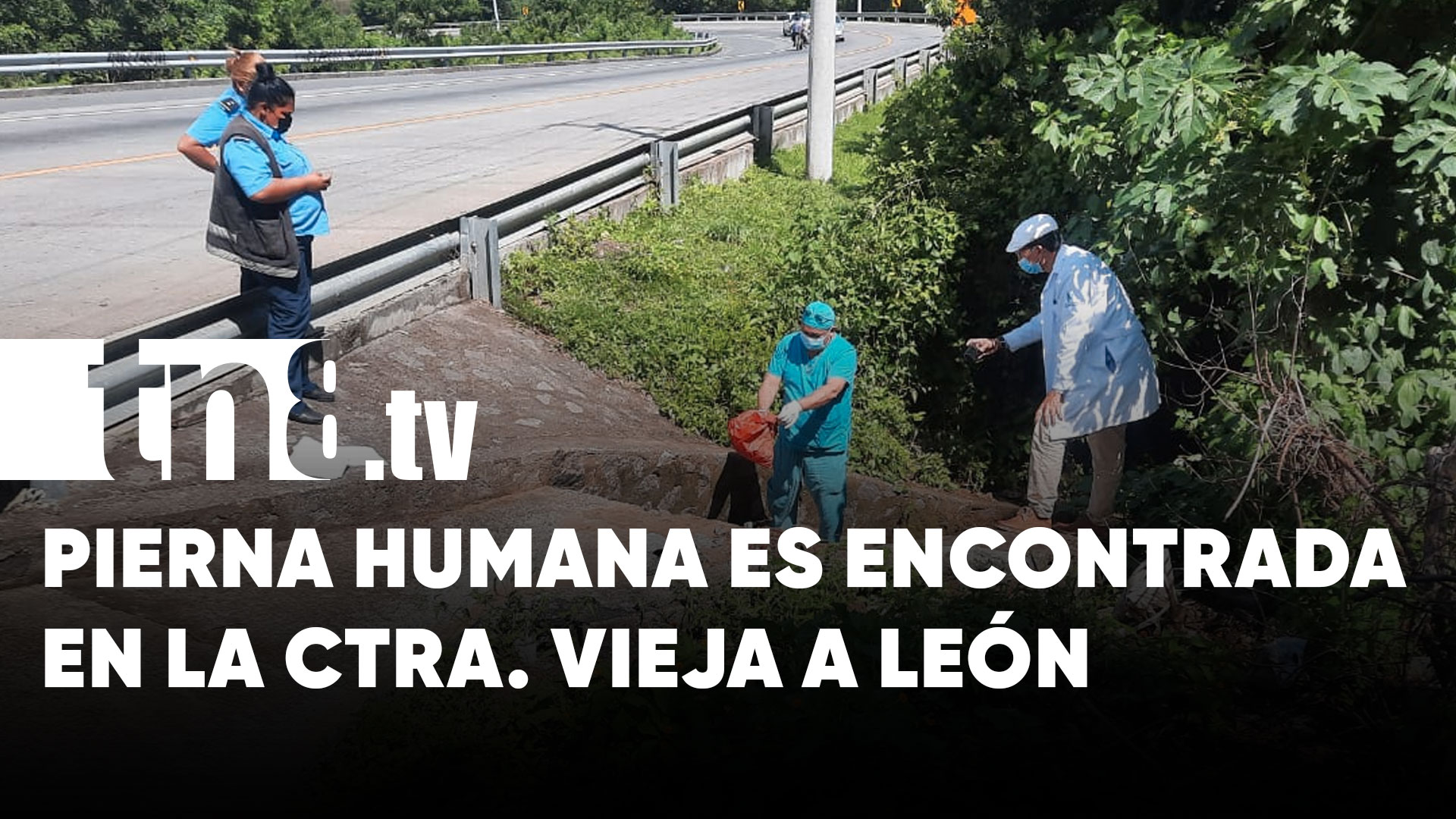 Encuentran pierna en estado de descomposición en el km 16.5 de la Ctra ...